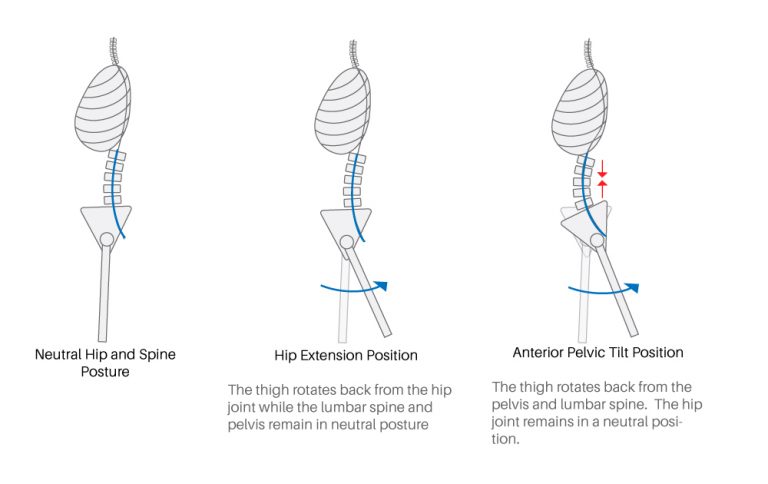 Correcting Hip Extension Mobility - My Rehab Connection